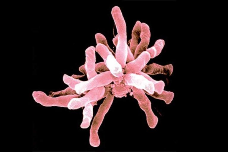Microrganismi Attivi, i microrganismi effettivi di Teruo Higa ...
